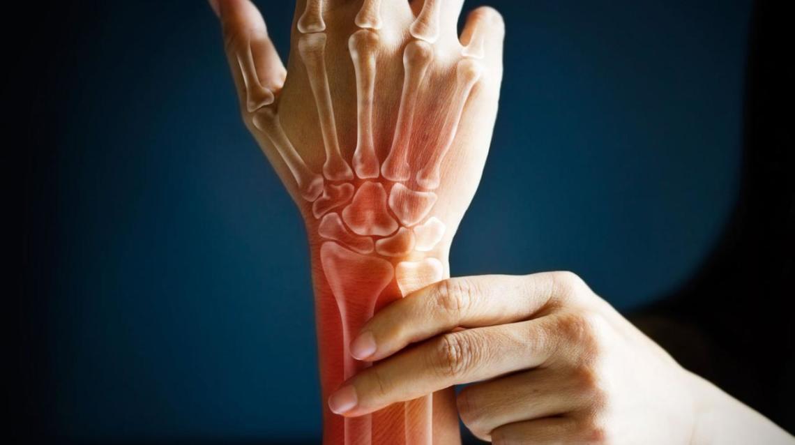 Bone Health: Tips to Keep Your Bones Healthy!