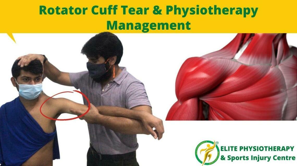 Rotator Cuff Tear and Physiotherapy Management