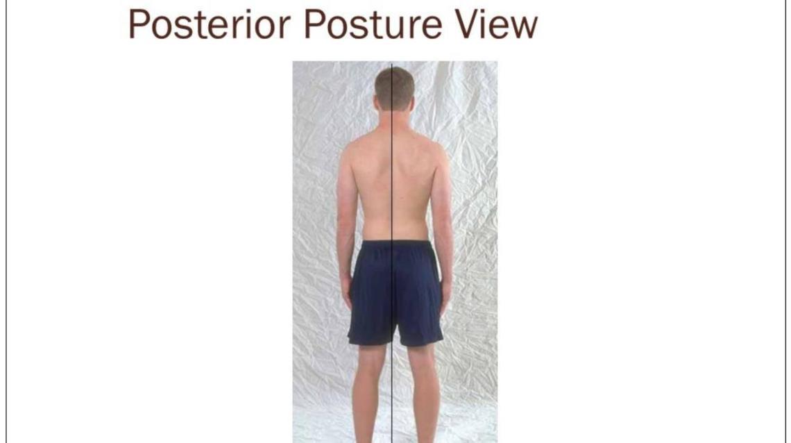 4 Key Points for Structurally Efficient Posture (Posterior View)