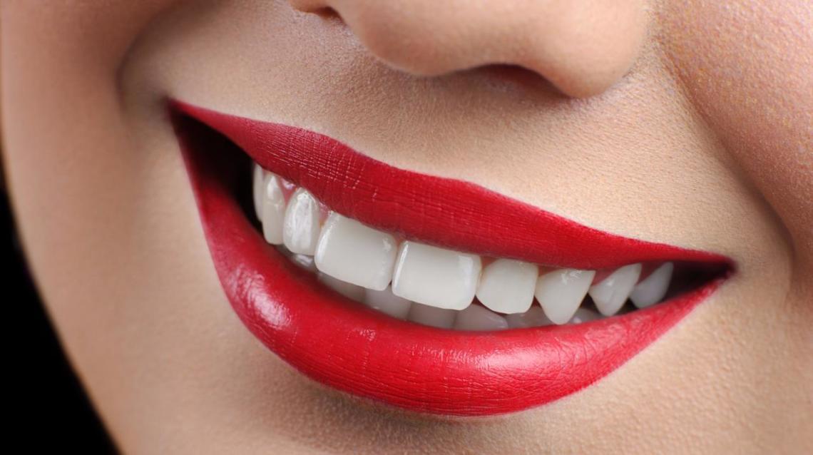 Finishing Touches - What you must know to preserve that smile!