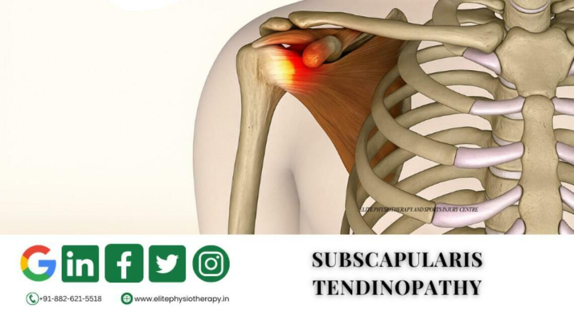 Shoulder Pain: Subscapularis Tendinopathy