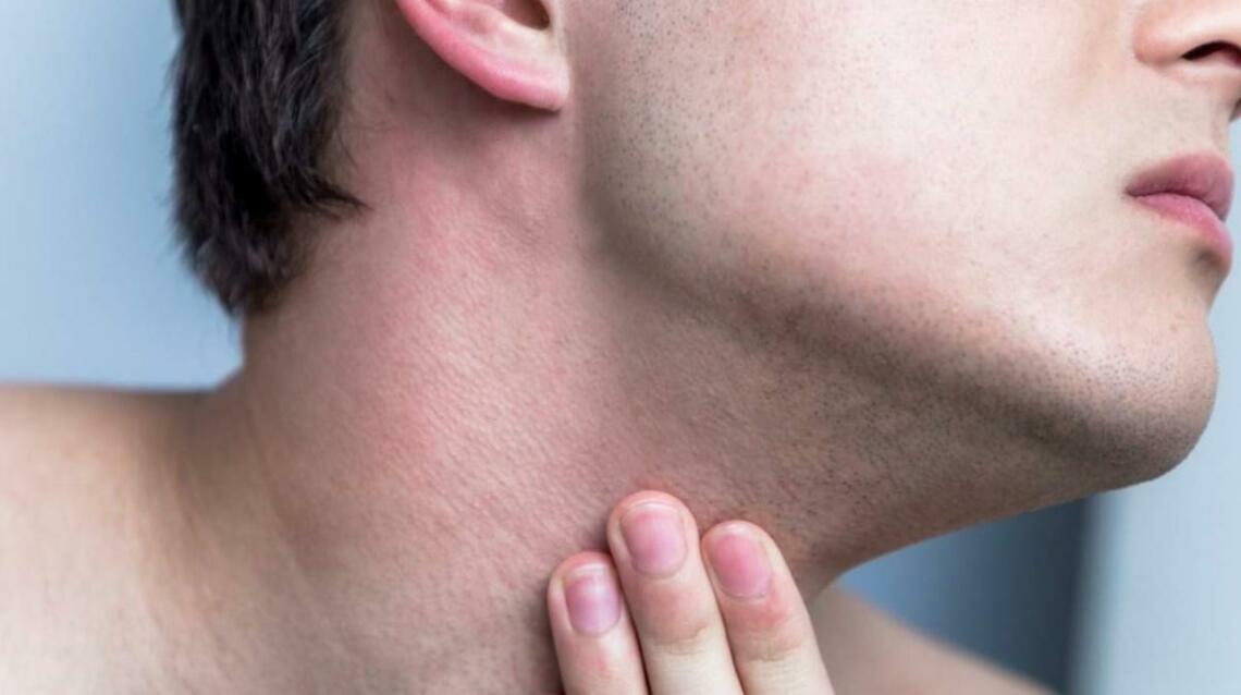 What Is Swelling Cause And Treatment Of Swelling