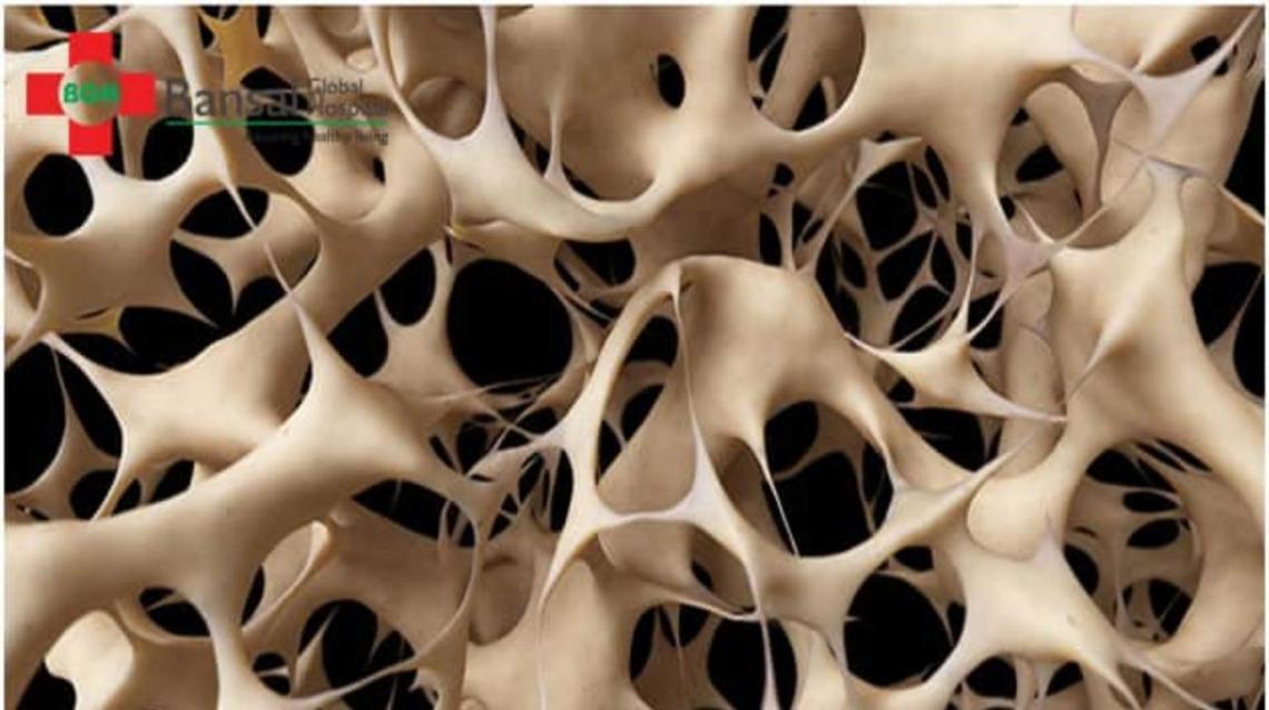 Is Your Bone Health Deteriorating? Here’s What Could Be Wrong