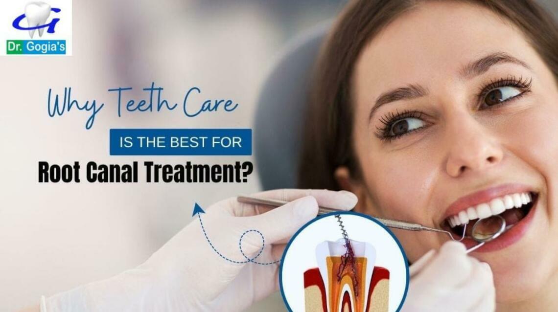 Why Teeth Care Is the Best for Root Canal Treatment