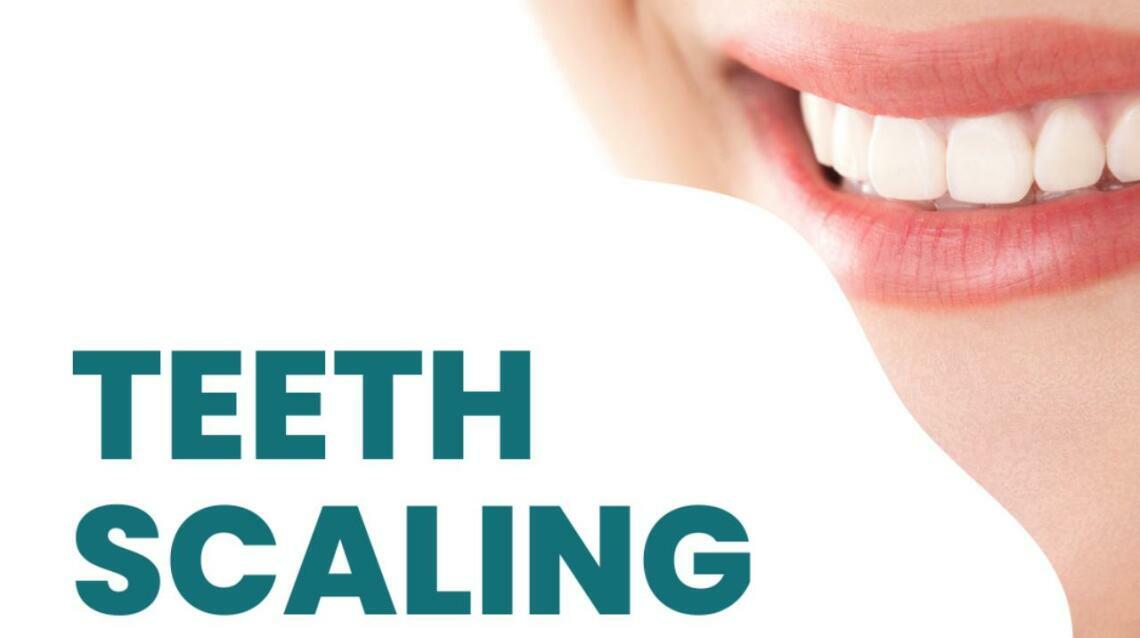 Tooth Scaling