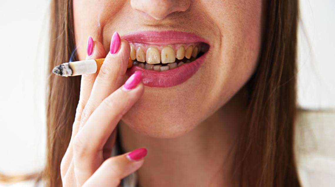 Effects of Smoking in Mouth!