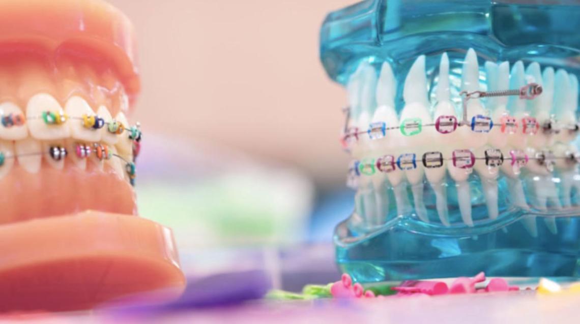 Steps Followed for the Best Orthodontic Treatment Process at Growing Smiles