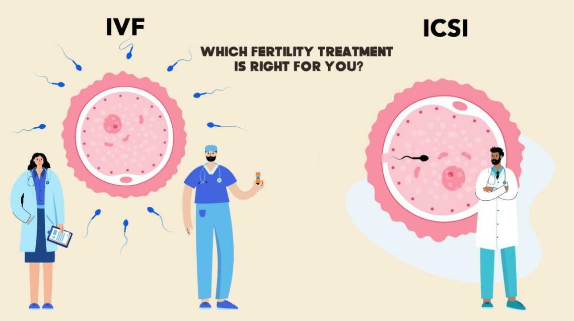 Ivf vs. Icsi: Which Fertility Treatment Is Right for You?