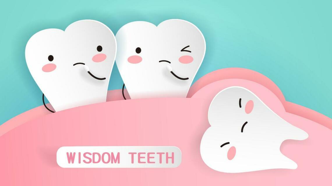 All About Wisdom Teeth