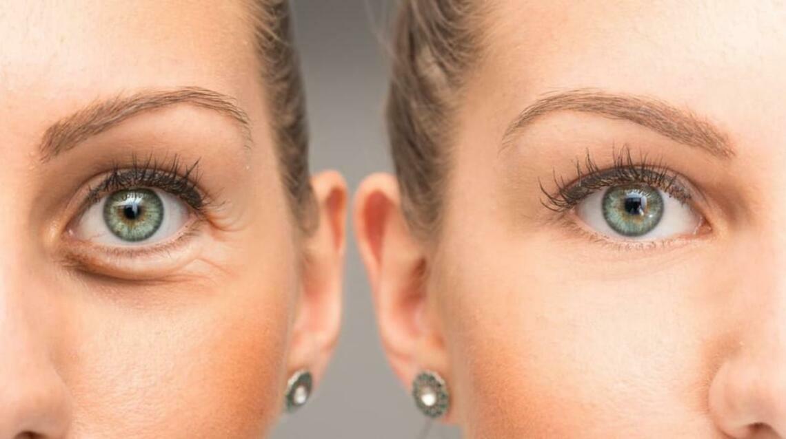 "Turn Back Time With Botox at Radiance Clinic”: