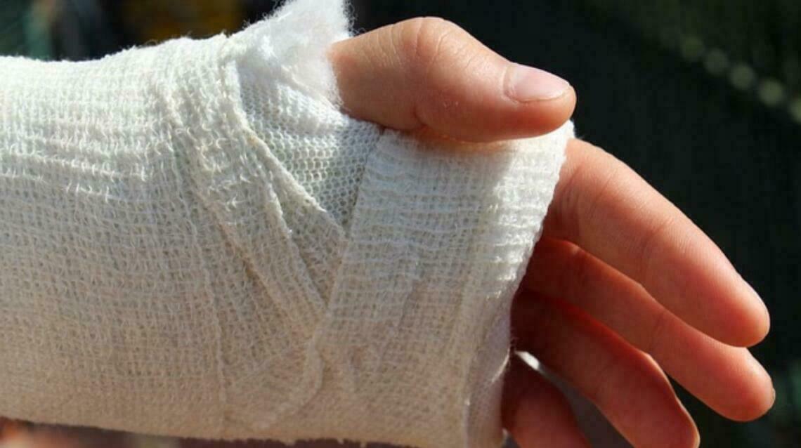 Casts and Splints: Care Tips for Recovery