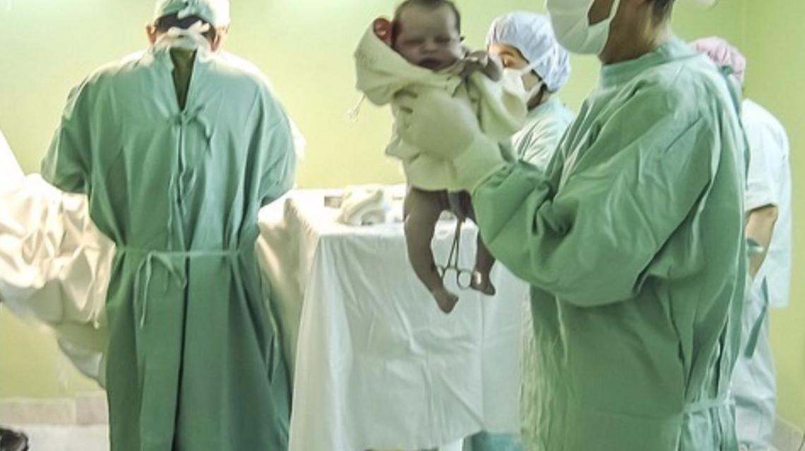 Baby Distressed? Delivery by Operation?