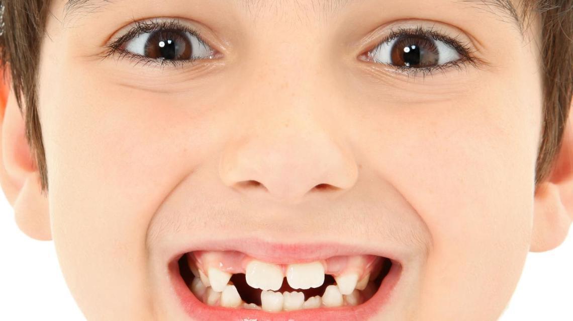 Why Milk Teeth Are Important?