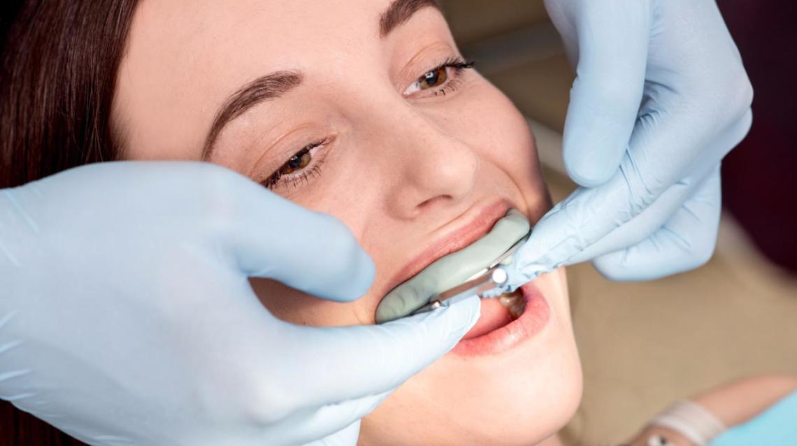 Lets Save the Mobile Tooth