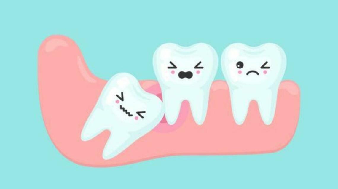 Wisdom Tooth Problems: Pain, Infection, and What You Should Do