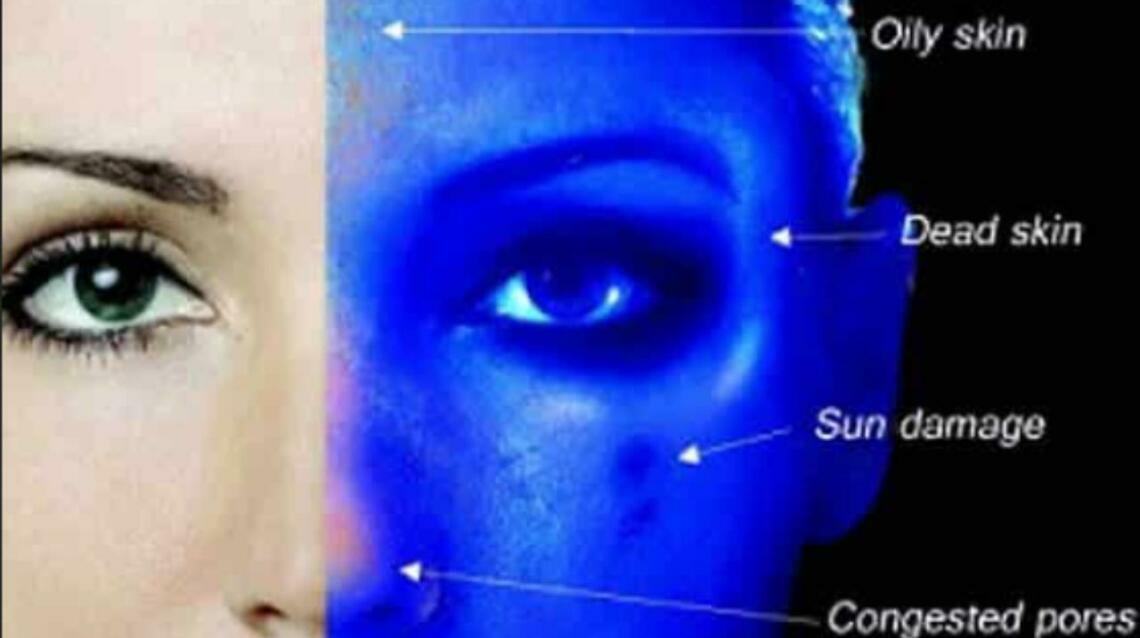 Know Thy skin.....