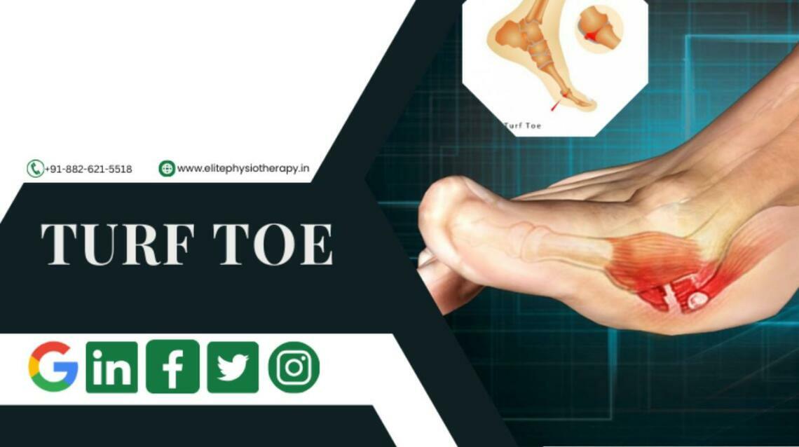 Turf Toe | Toe Injury