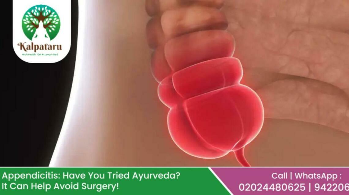 Appendicitis: Have You Tried Ayurveda? It Can Help Avoid Surgery!