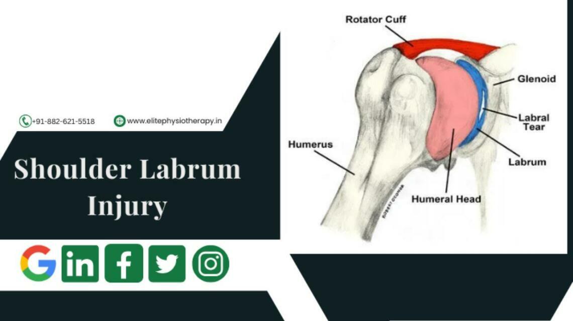 Shoulder Labrum Injury: Physiotherapy Management at Elite Physiotherapy