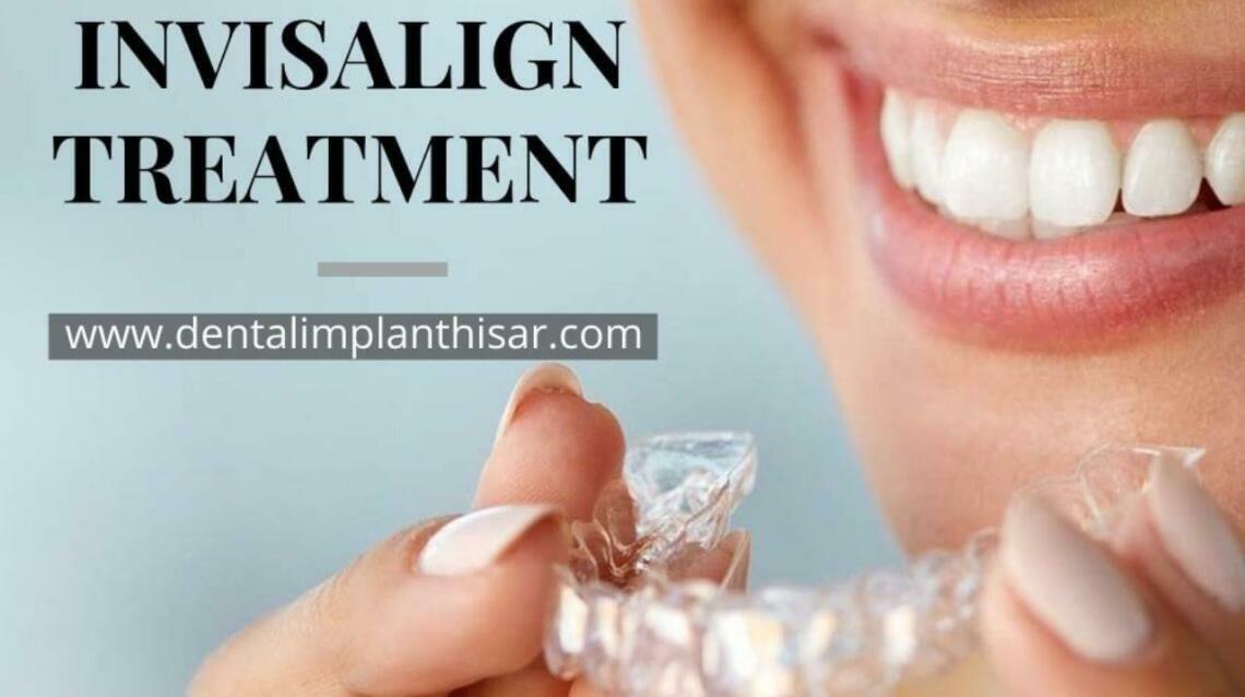 8 Benefits of Invisalign
