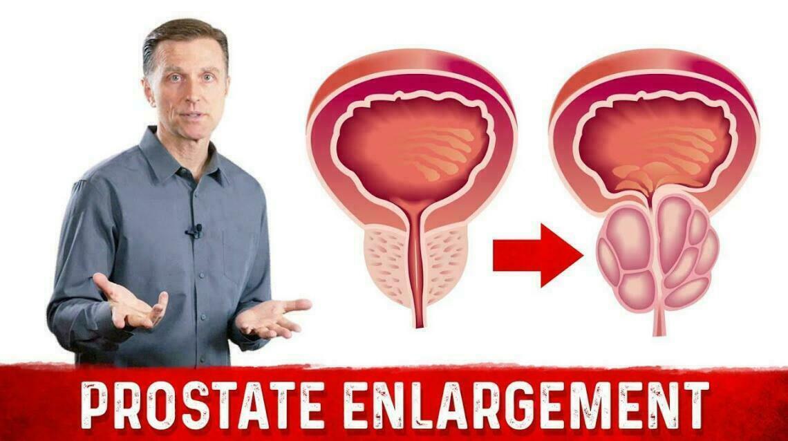 Prostate Gland: Basic Facts Need to Know