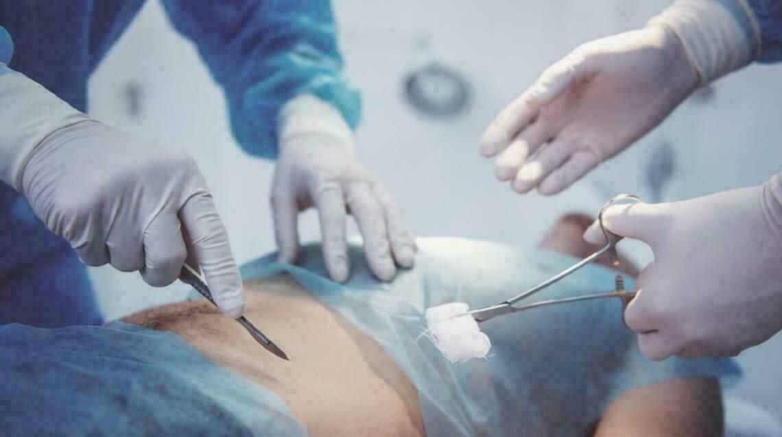 Male-to-Female (Mtf) Gender-Affirming Surgeries: A Complete Guide