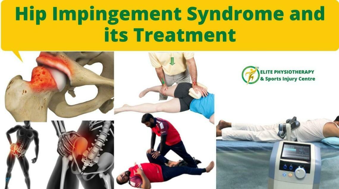 Hip Impingement Syndrome Exercises