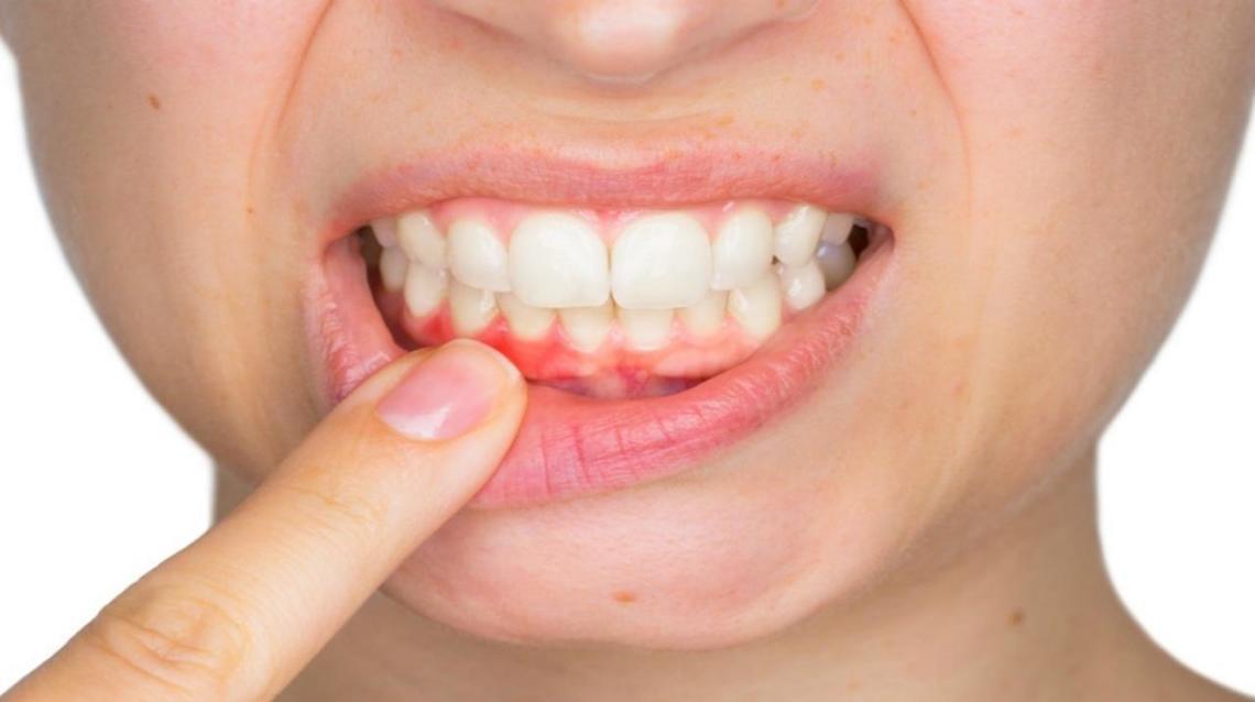 Gum Disease and Its Effects