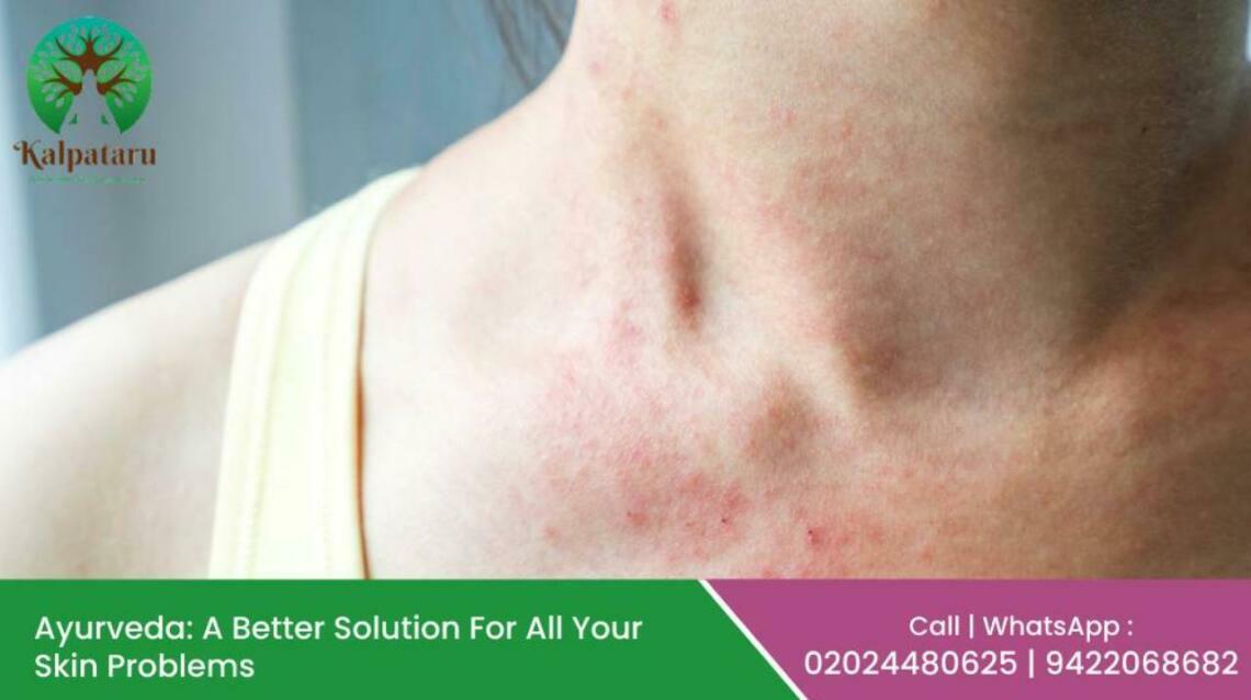 Ayurveda: A Better Solution for All Your Skin Problems