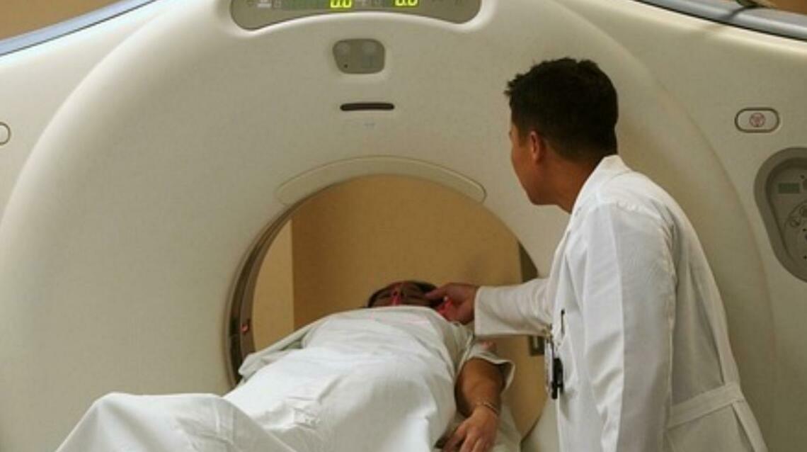 Ct Coronary Angiography – a Simple Non-Invasive Tool to Diagnose Heart ...