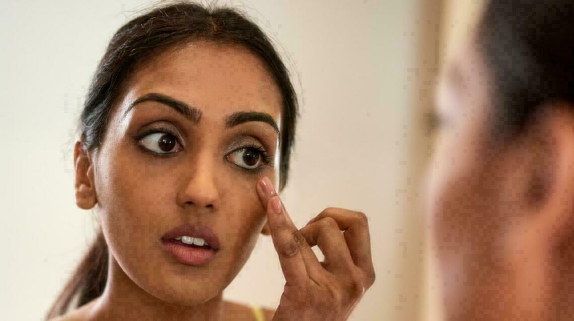 Tear Trough Deformity- a Lesser Known Cause of Dark Circles!