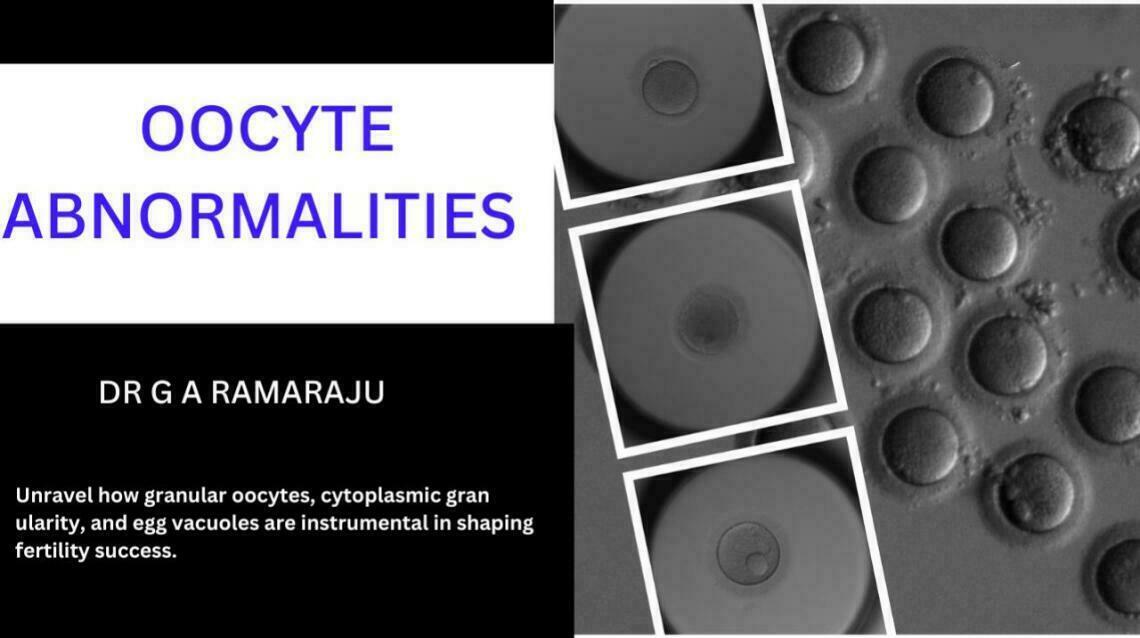 Peering Into the Petri Dish: A Close-Up on Oocyte Quality.