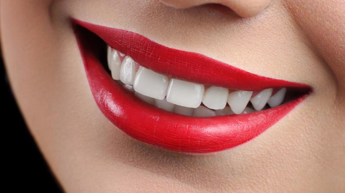 A Bride’s Pre-Wedding Smile Checklist