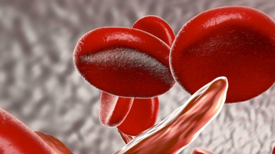 5 Most Common Blood Disorders and What to Do Next: