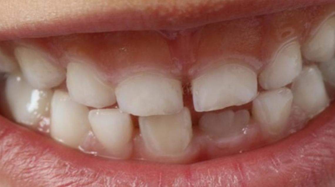 how to care for child's teeth