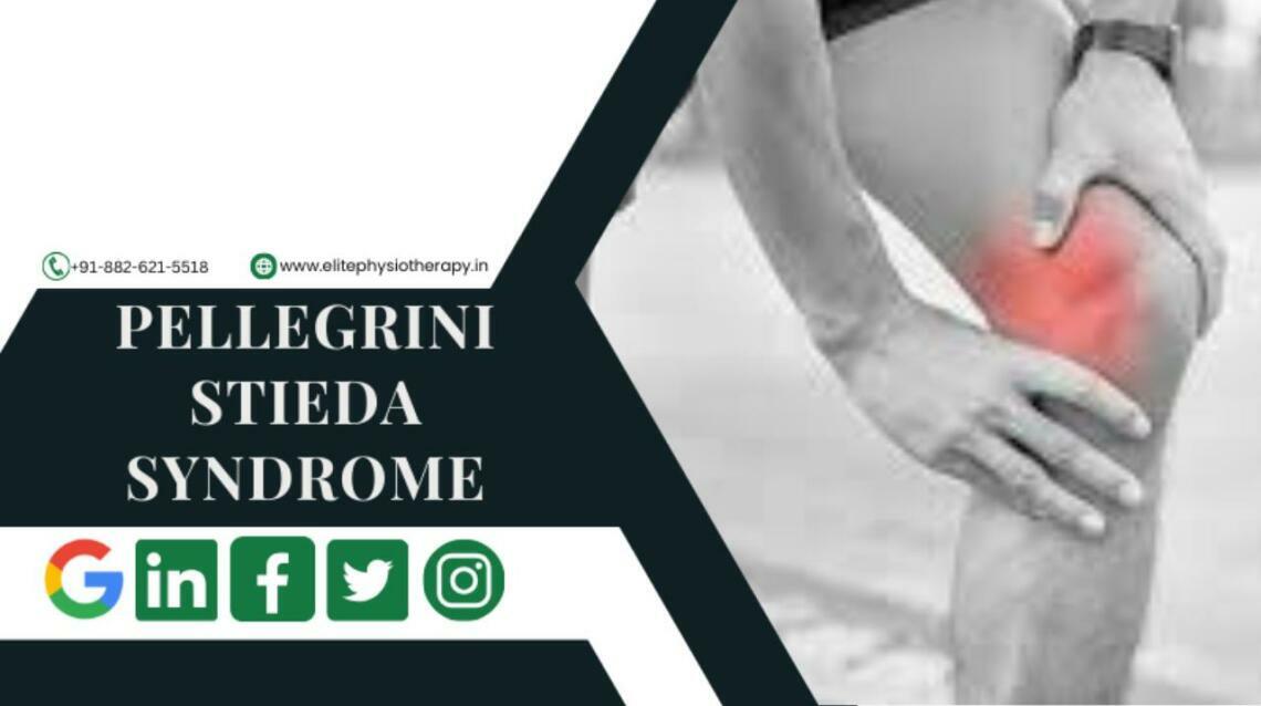 Pellegrini Stieda Syndrome